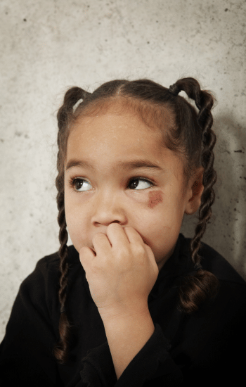 5 Most Common Signs of Anxiety in Children — Linden Tree Counseling, PLLC