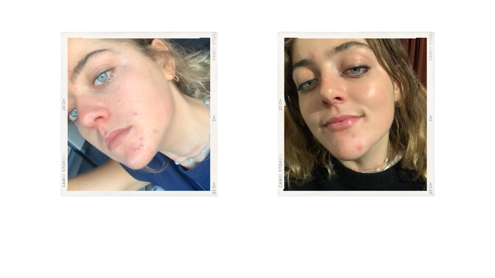 Rosie Reviews: SugarBaby Skincare. — billie