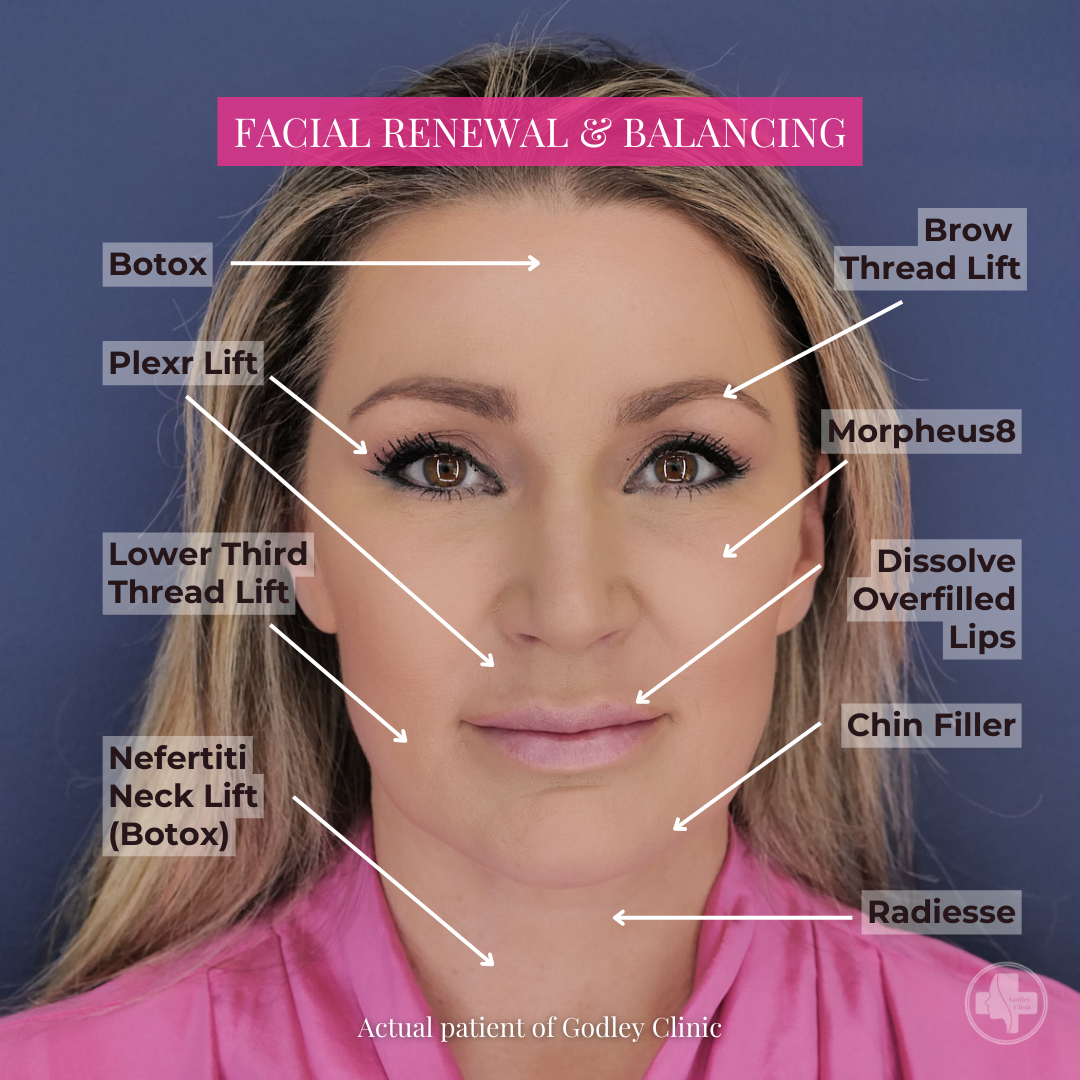 The Art and Science of Facial Balancing at Godley Clinic — Godley Clinic