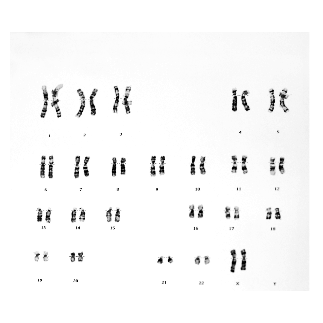 Navigating Genetic Testing While Pregnant I Modern Reproduction