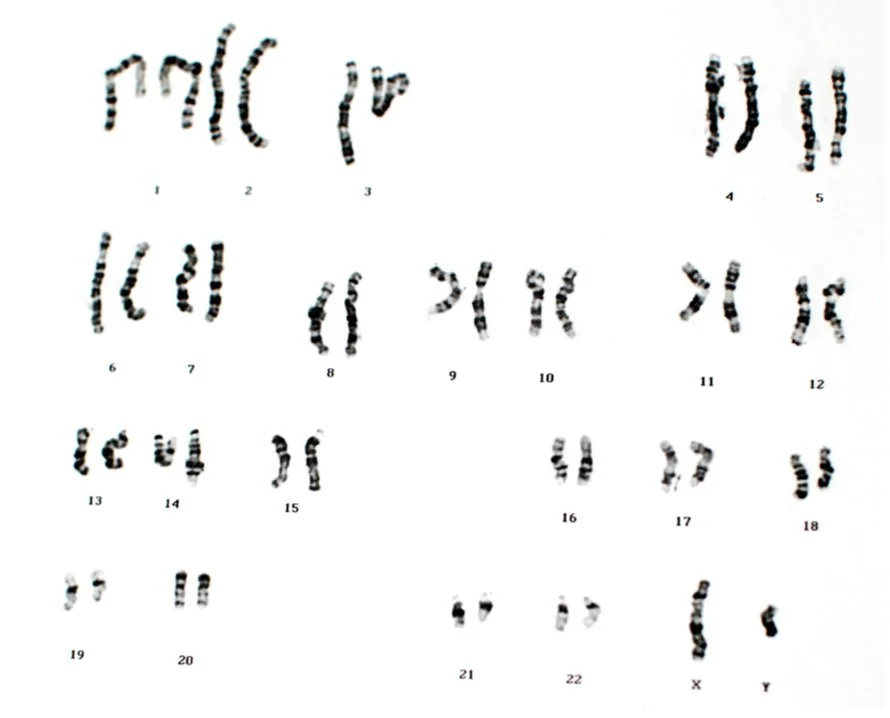 What is the difference between a karyotype and microarray analysis? I ...