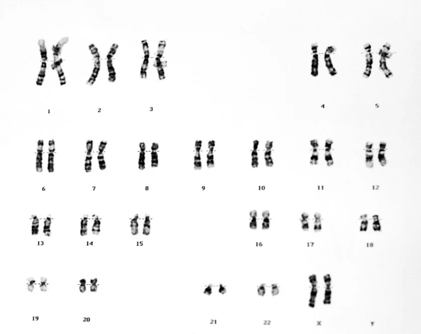 What is the difference between a karyotype and microarray analysis? I ...