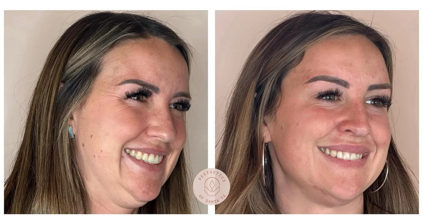 PDO Threads — Aesthetics Of Santa Fe