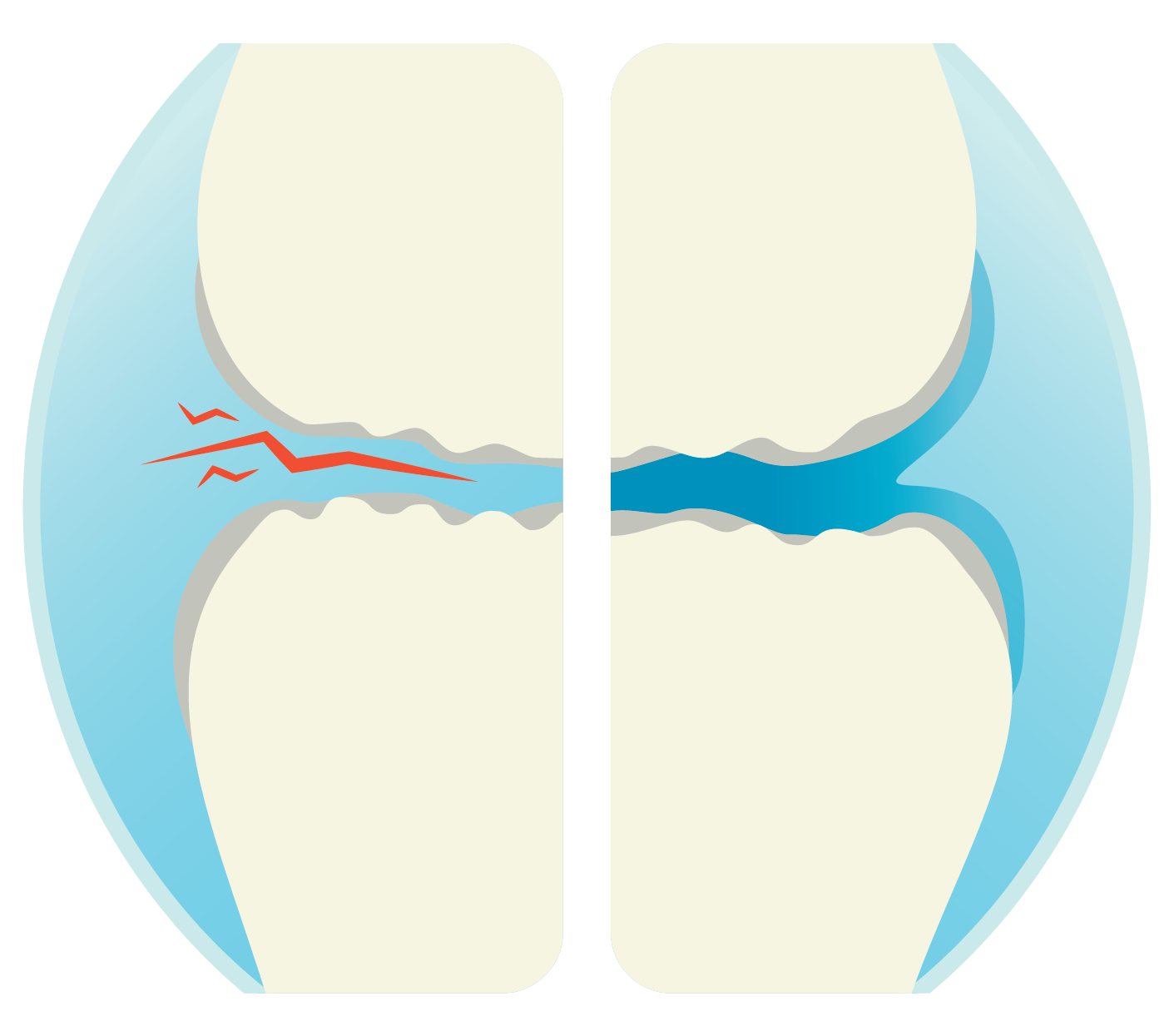 Spryng | Veterinary injection treatment for lameness, joint pain and OA