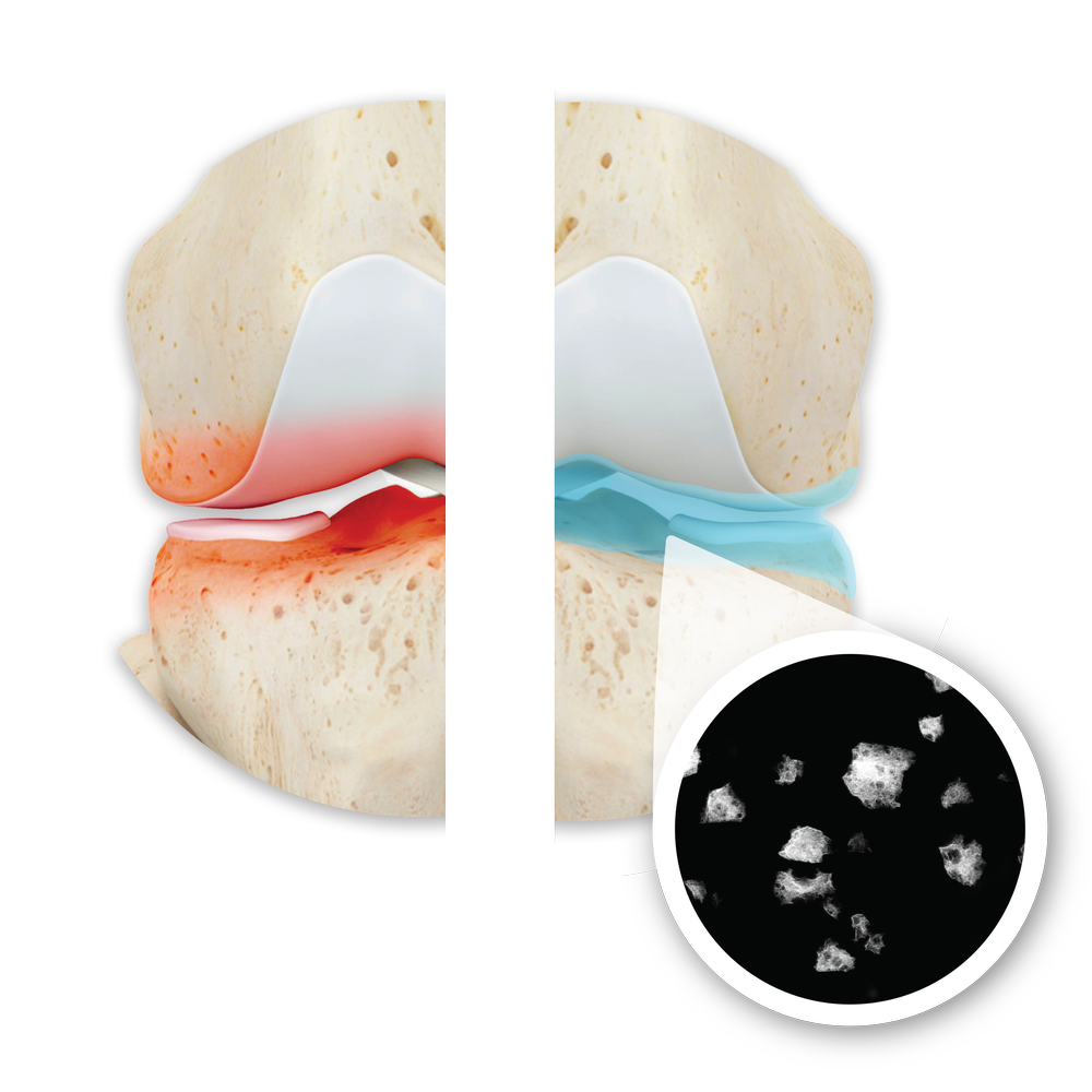 Spryng | Veterinary injection treatment for lameness, joint pain and OA
