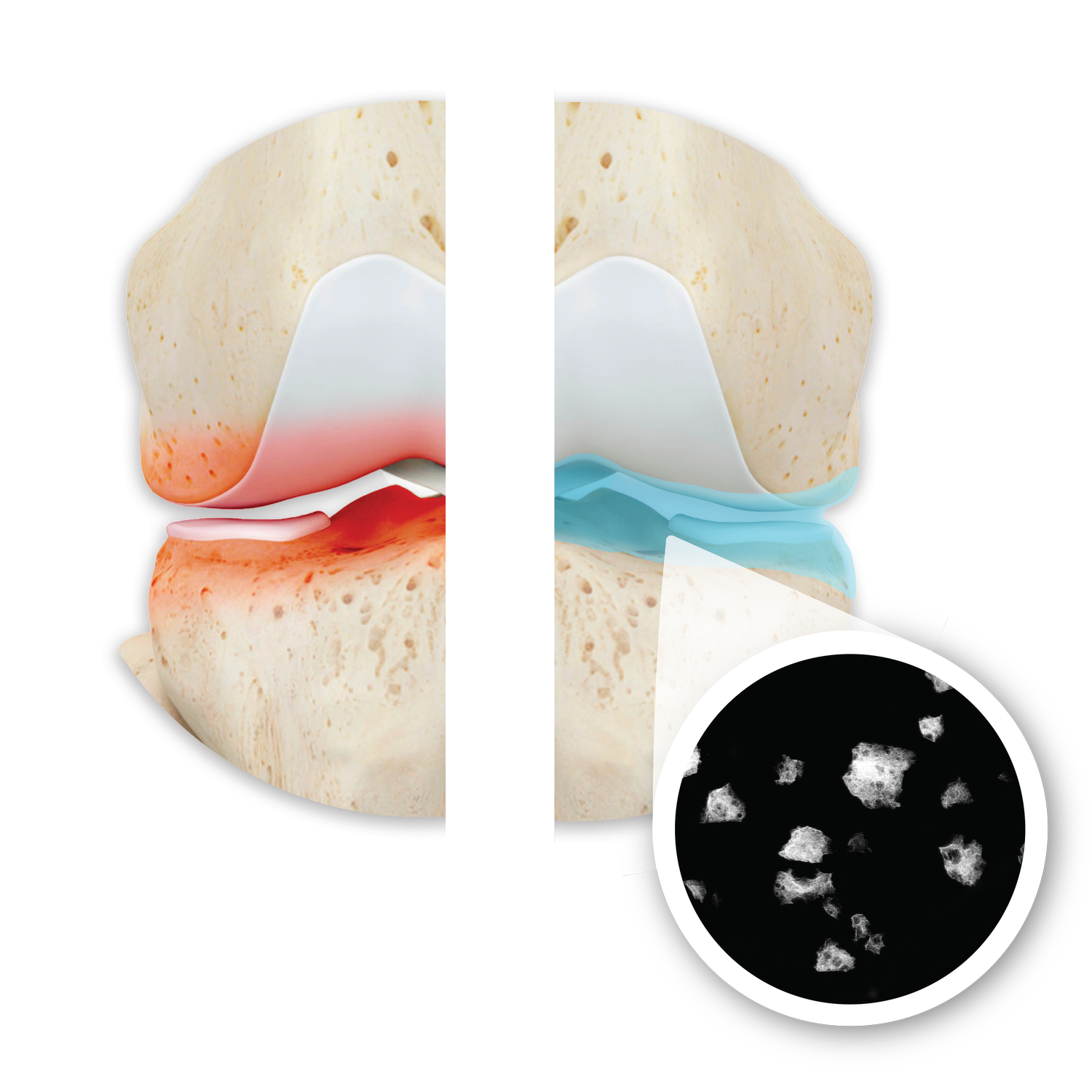 Spryng | Veterinary injection treatment for lameness, joint pain and OA