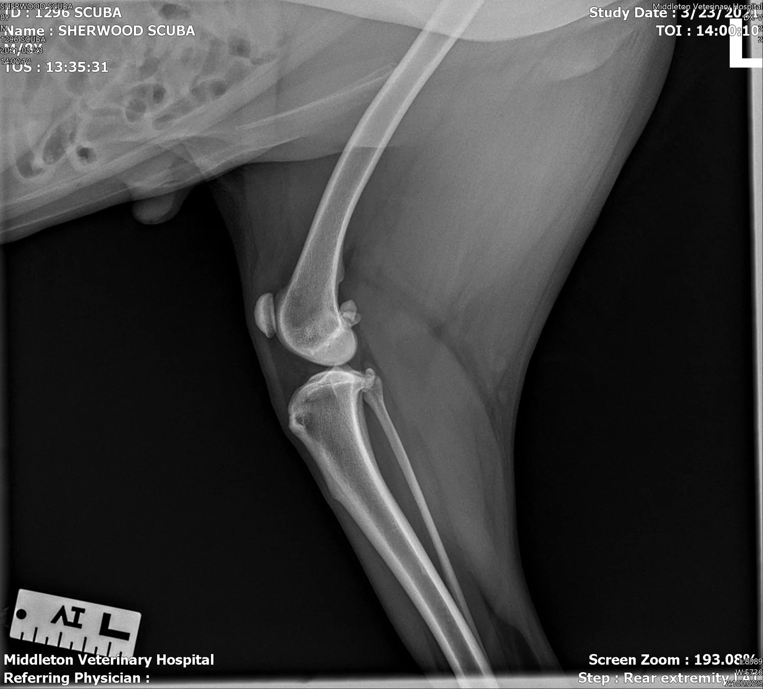 SCUBA : partial CCL tear > — Spryng™ with OsteoCushion™ Technology