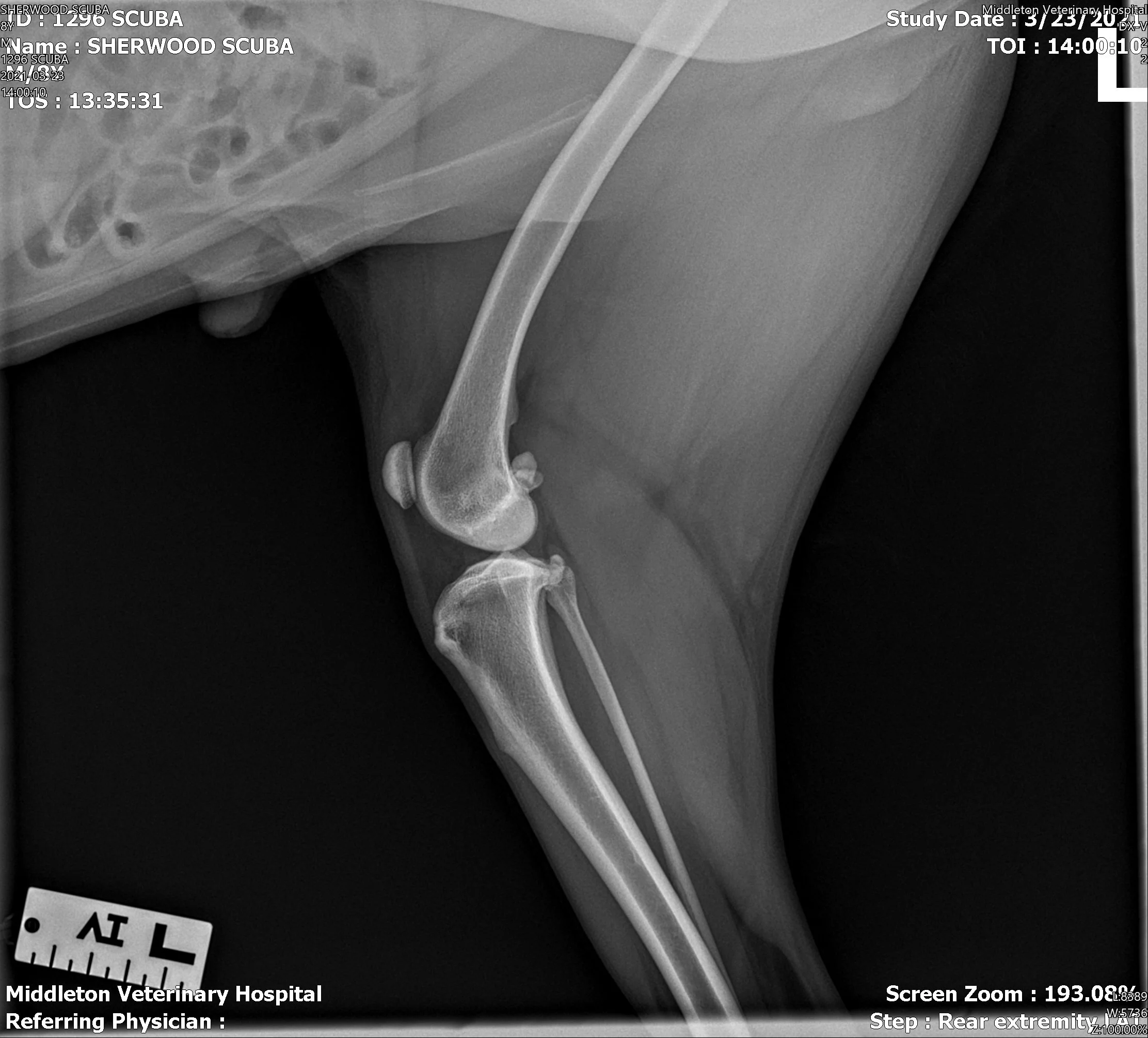 Scuba Partial Ccl Tear — Spryng™ With Osteocushion™ Technology
