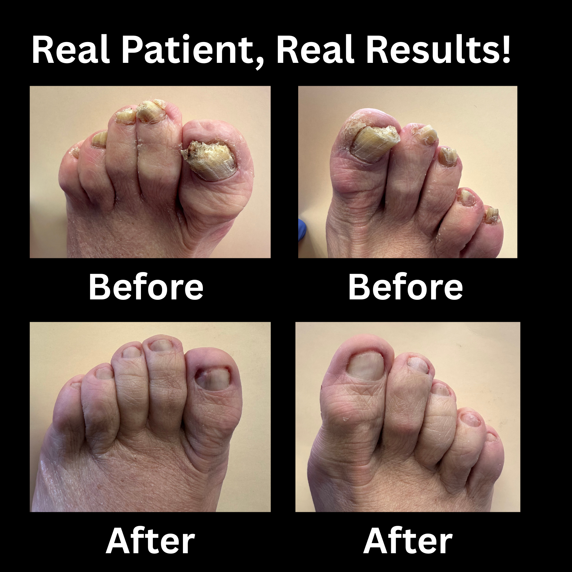 Concierge Podiatry & Spa, Before and after pics for Groupon — Concierge Podiatry & Spa
