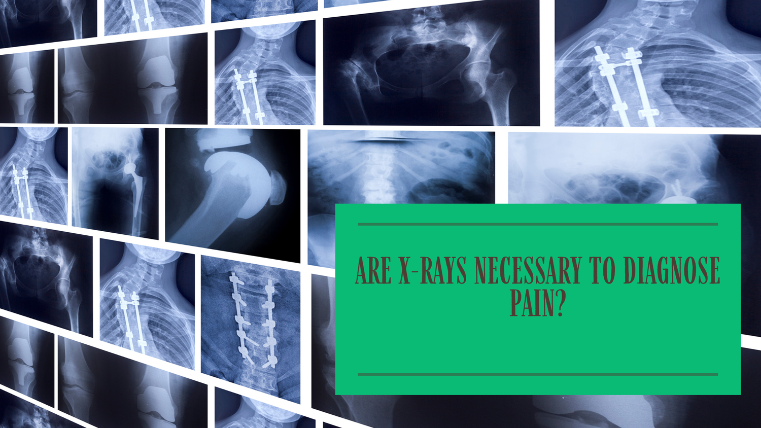 Are X-Rays Necessary to Diagnose Pain? — PhysioLogic TX
