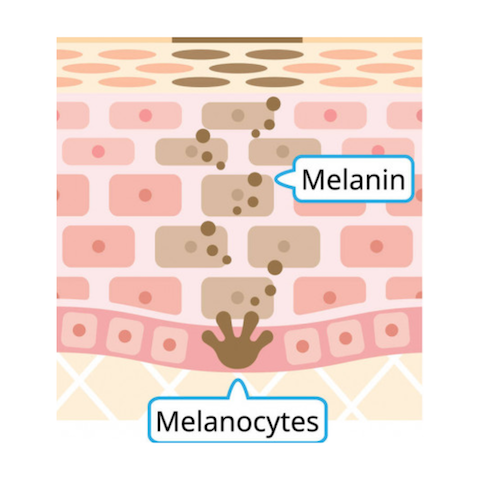 The Final Boss Hyperpigmentation Treatment Guide To End All Hyperpigme ...