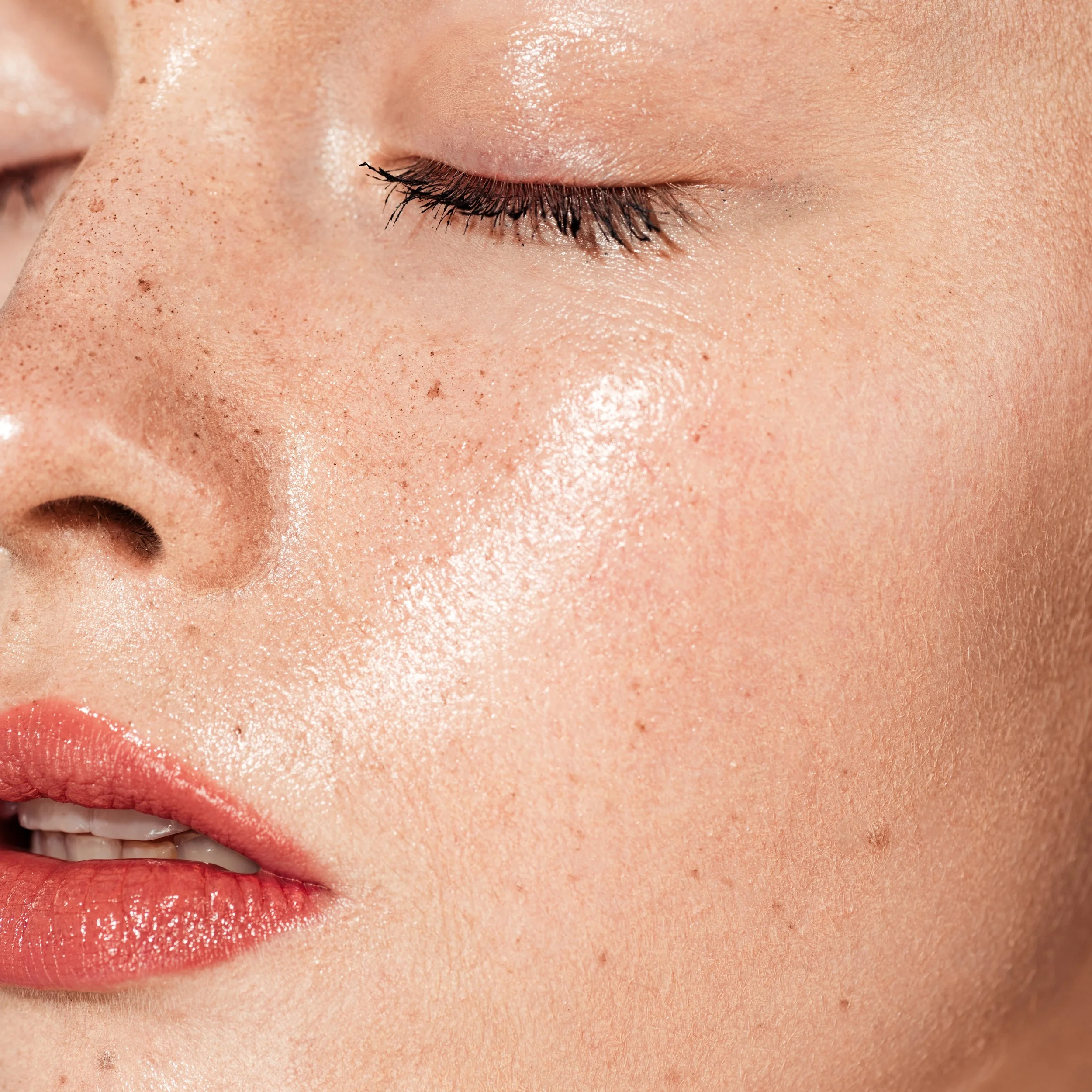 Skin Boosters: Skinvive Is Injectable Skin Care for All Ages — FACE