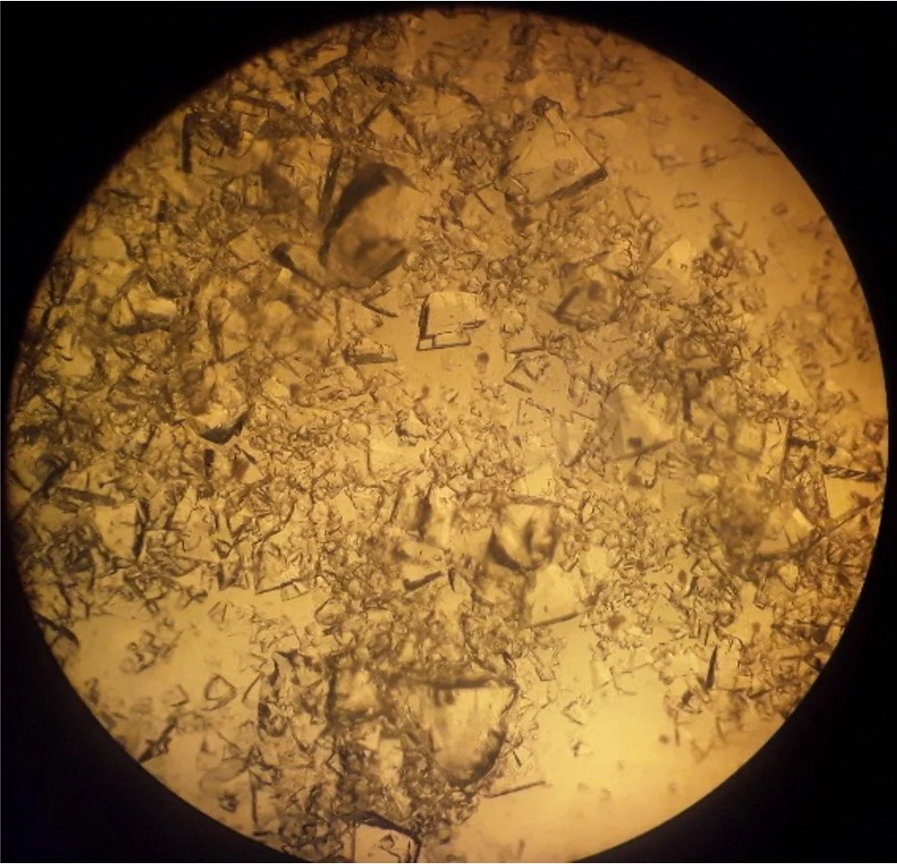 Controlling the cooling crystallization of lactose — Zutora