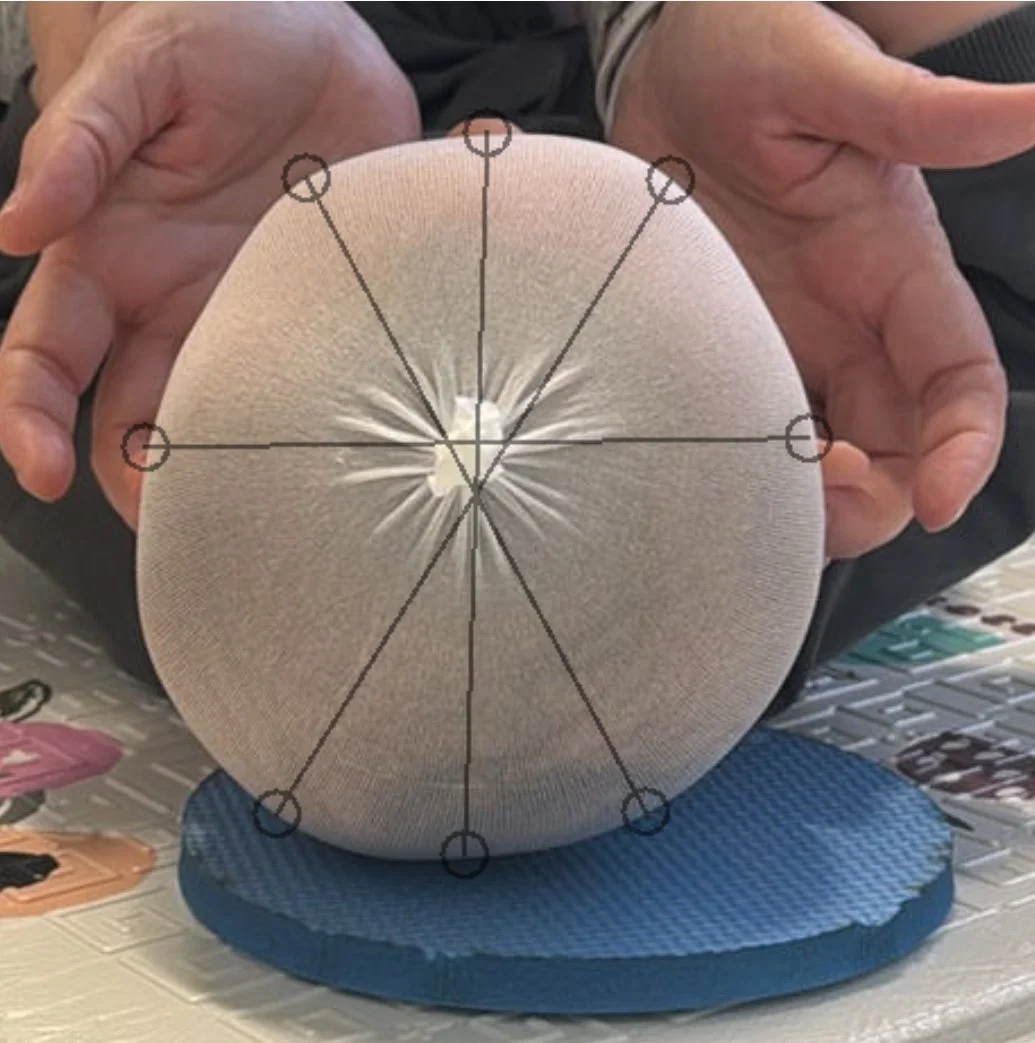 Understanding CVAI and CI Numbers for Infant Head Shape: A Guide to ...