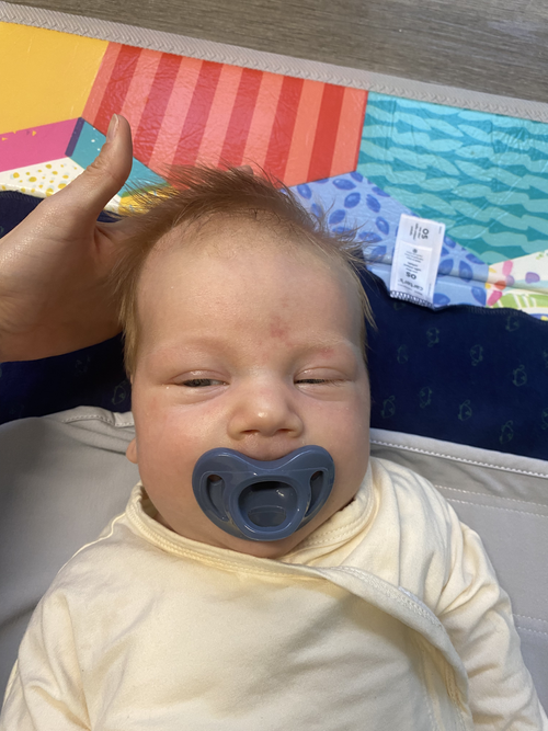 Brachycephaly, scaphocephaly, plagiocephaly, oh my! — Year One Wellness ...