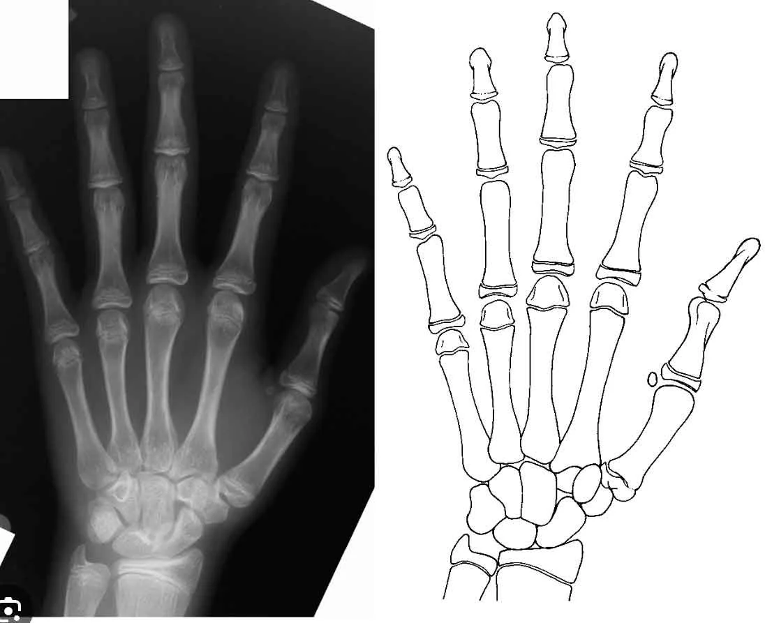 Medical Imaging Relevant to Scoliosis Care | Schroth DC