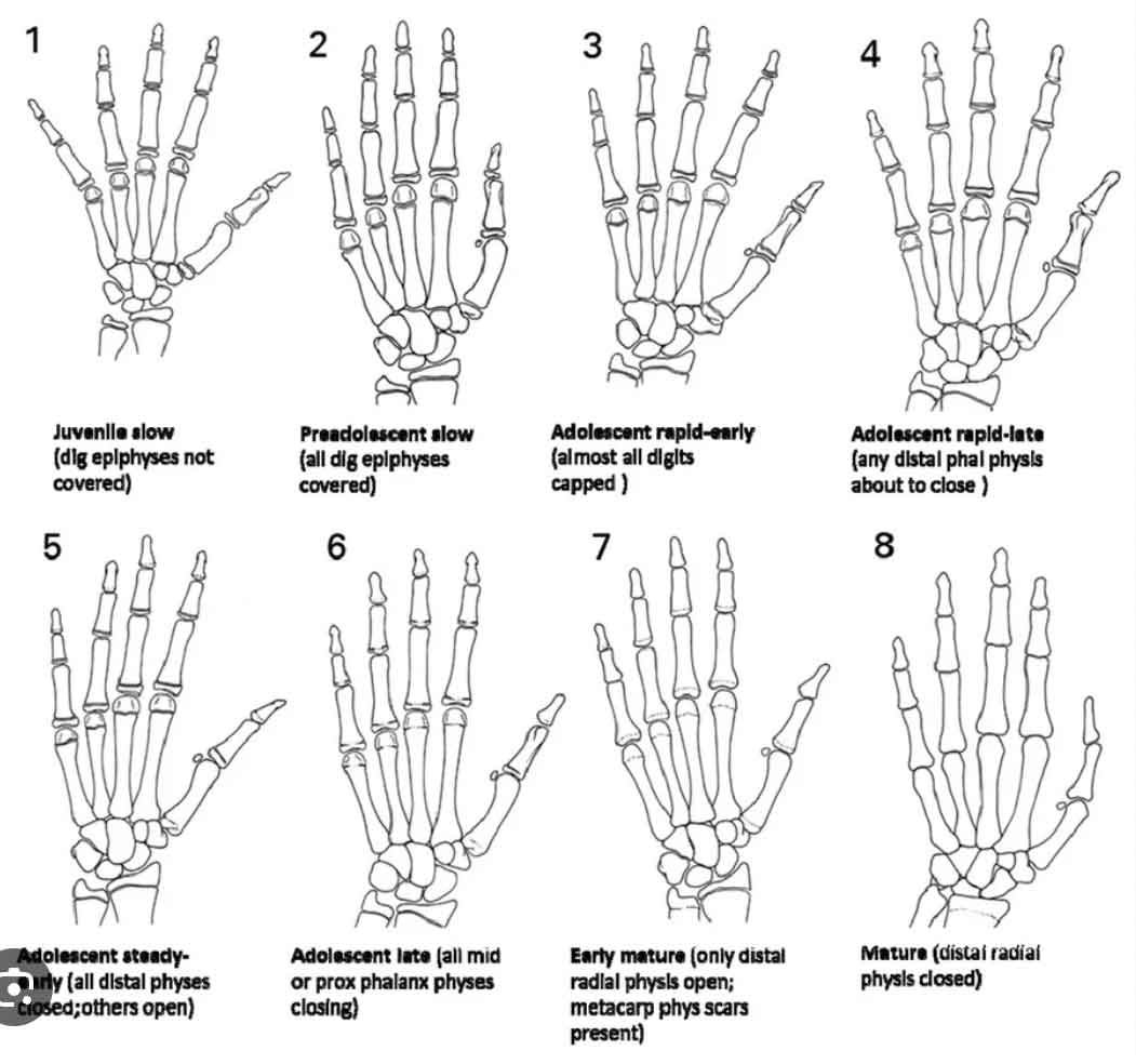 Medical Imaging Relevant to Scoliosis Care | Schroth DC
