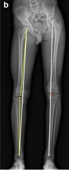 Medical Imaging Relevant to Scoliosis Care | Schroth DC