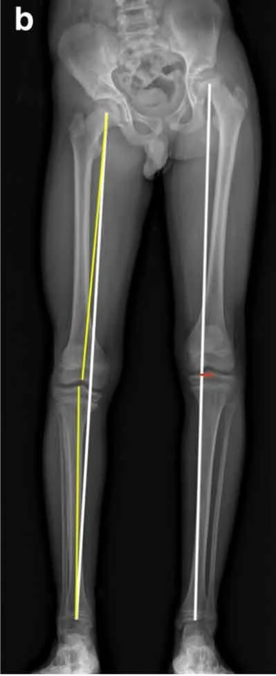 Medical Imaging Relevant to Scoliosis Care | Schroth DC