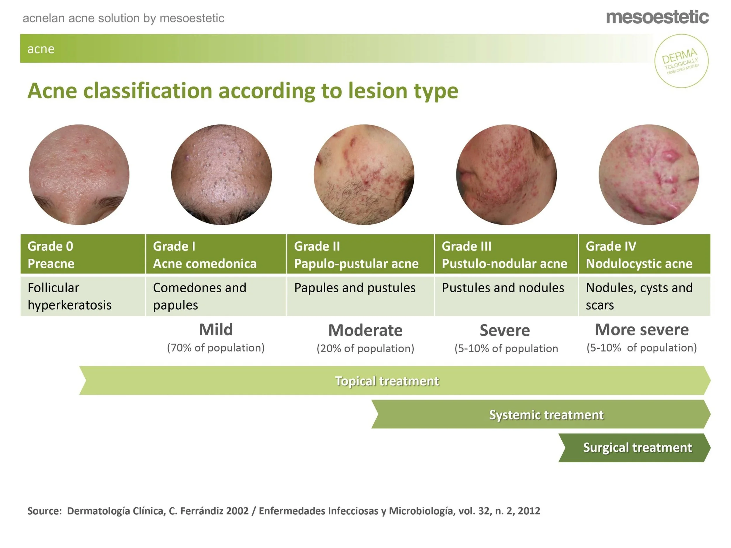 Acnelan Acne and Acne Scars Treatment, Auckland — Beautilase