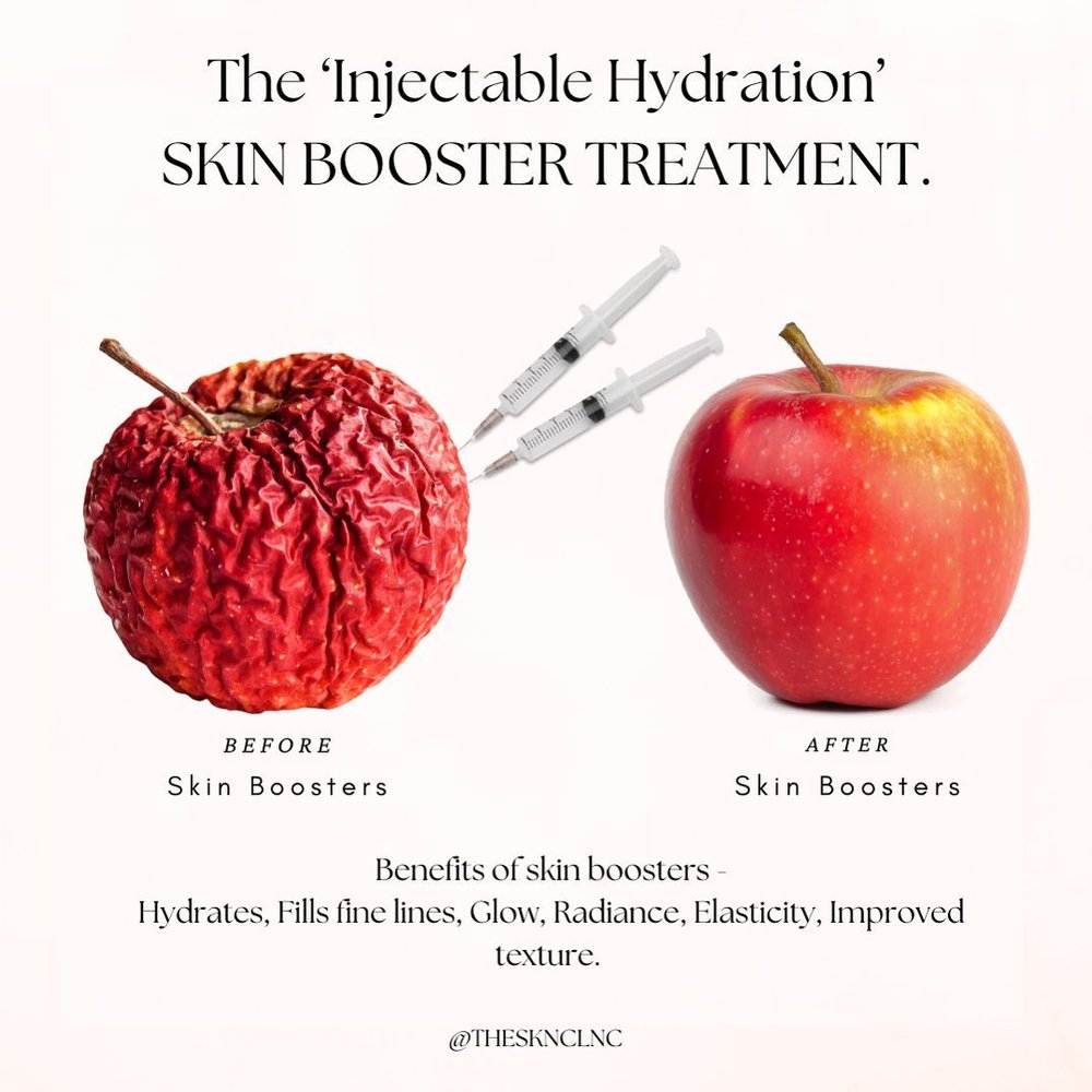 Skin Boosters What Are They The Benefits And When To Have Them