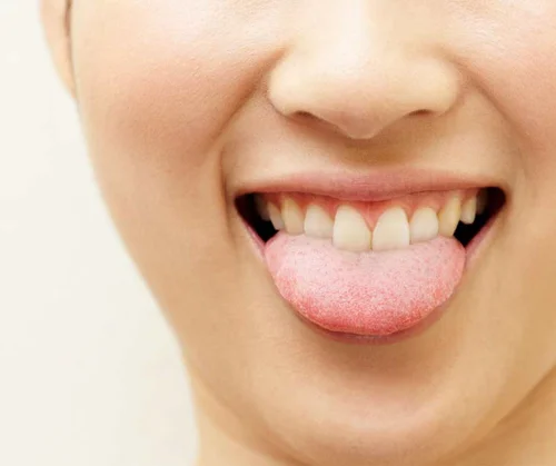 Is a Lisp a Speech Impediment?