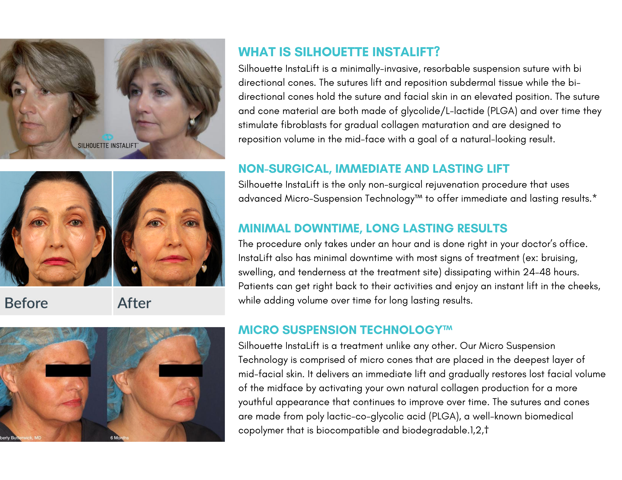 Non-surgical facelift — Bluewaters Spa & Sculpt