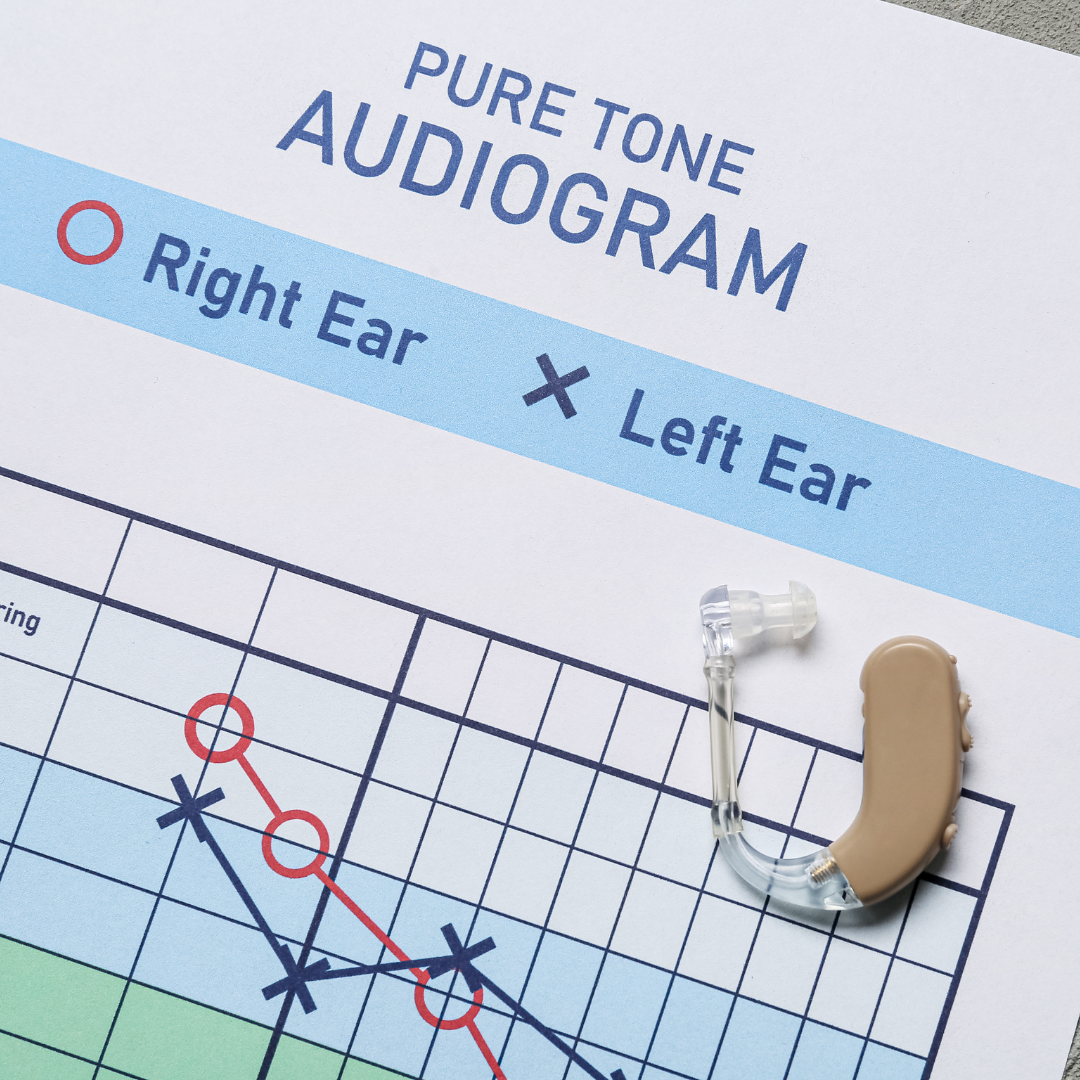Hearing Tests: Your Guide to Preparation and Expectations — InnoCaption