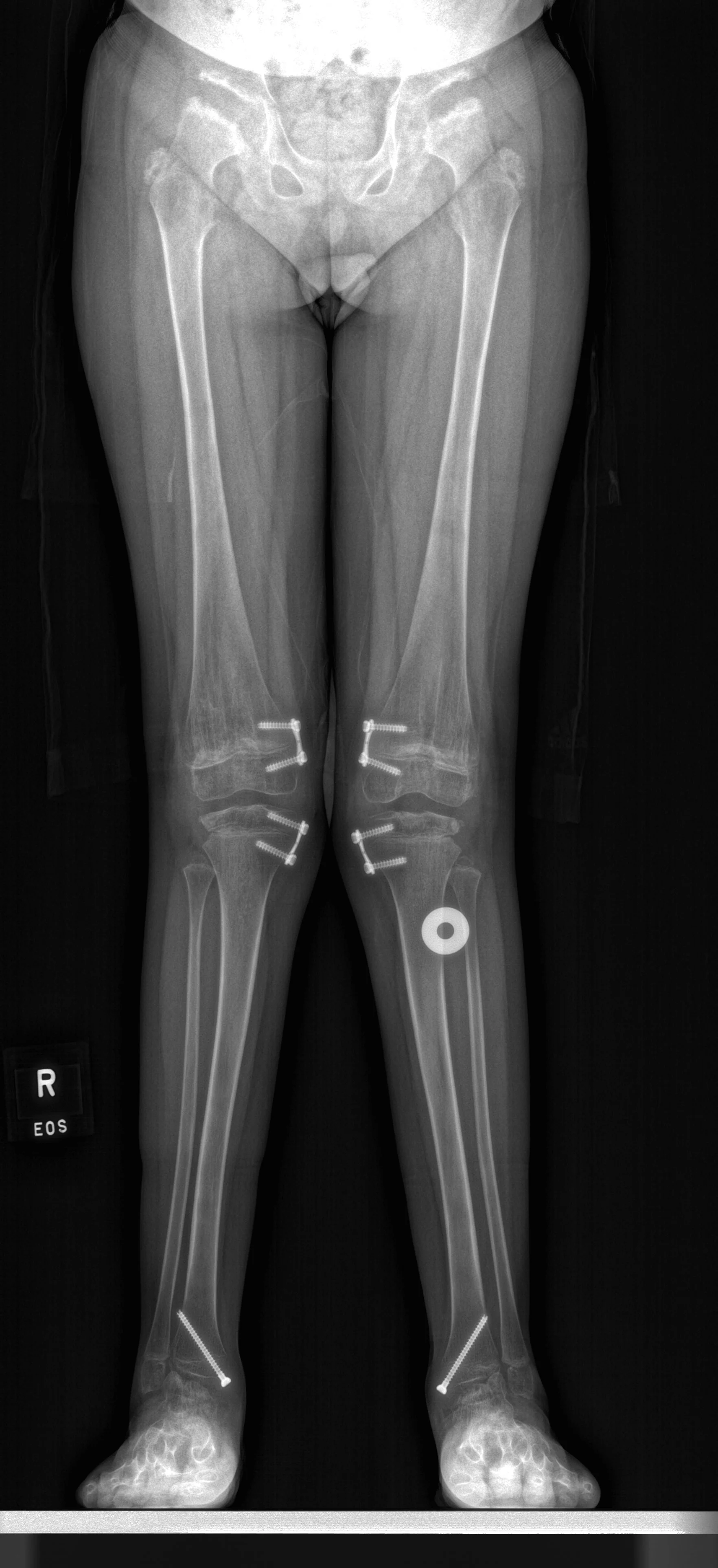 Services — International Limb Differences Network