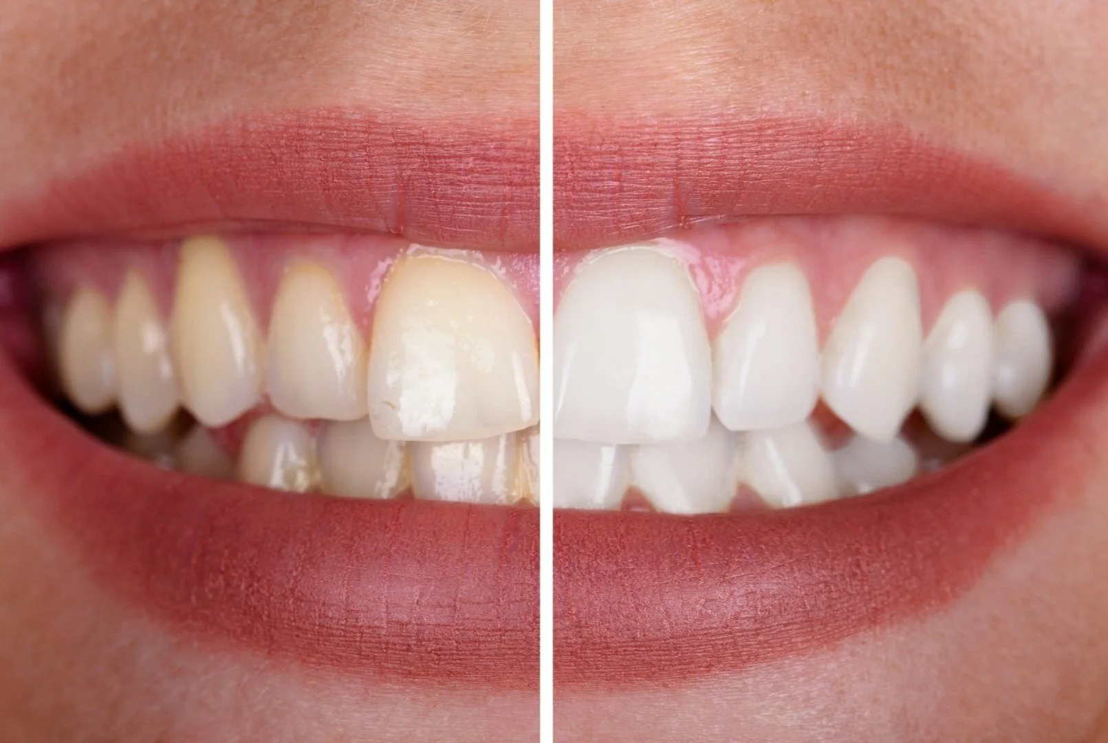 Logan & Fritsch - Huntsville, TX Dentists - Implants