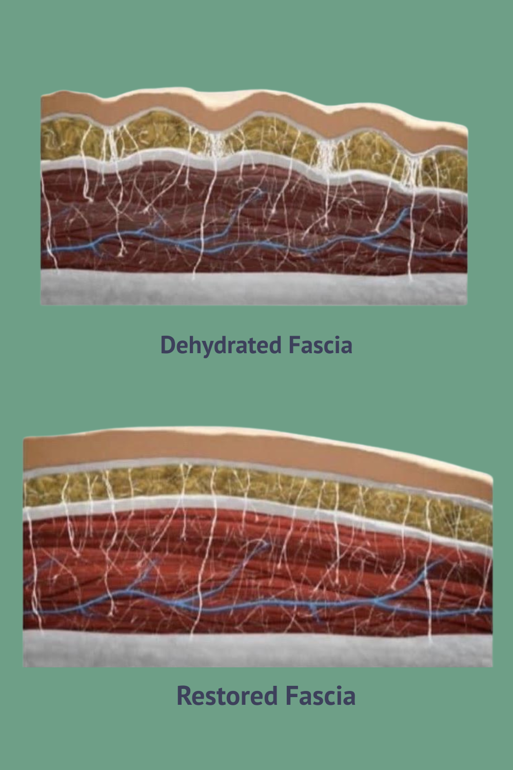Fascia 101: The Hidden Tissue That Could Be Causing Your Tightness ...