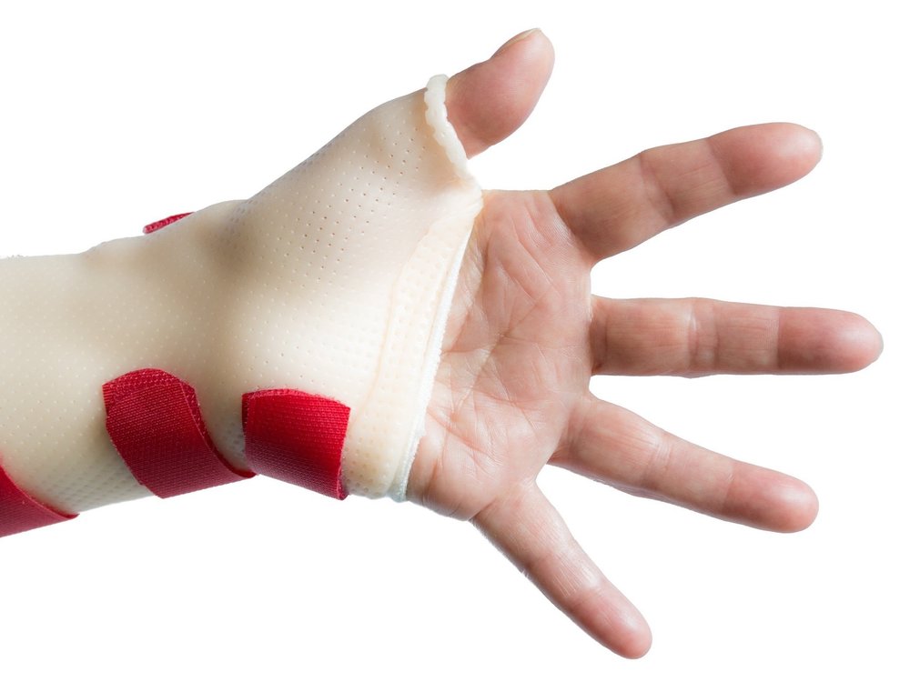 OT Hand Splinting Workshops | Occupational Therapy Splinting Training ...