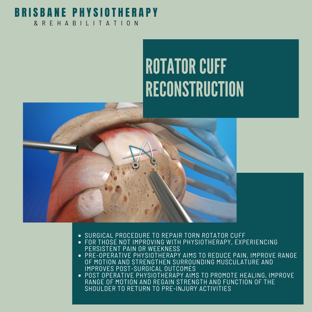 Rotator Cuff - Pain, Issues, Treatment, Reconstruction & Tendinopathy ...