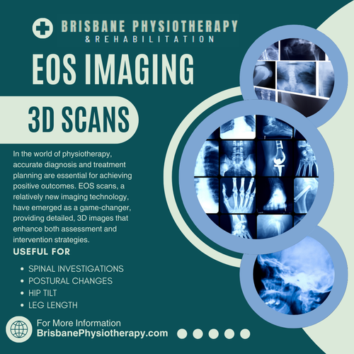 Understanding EOS Scans and Their Impact on Physiotherapy Outcomes ...