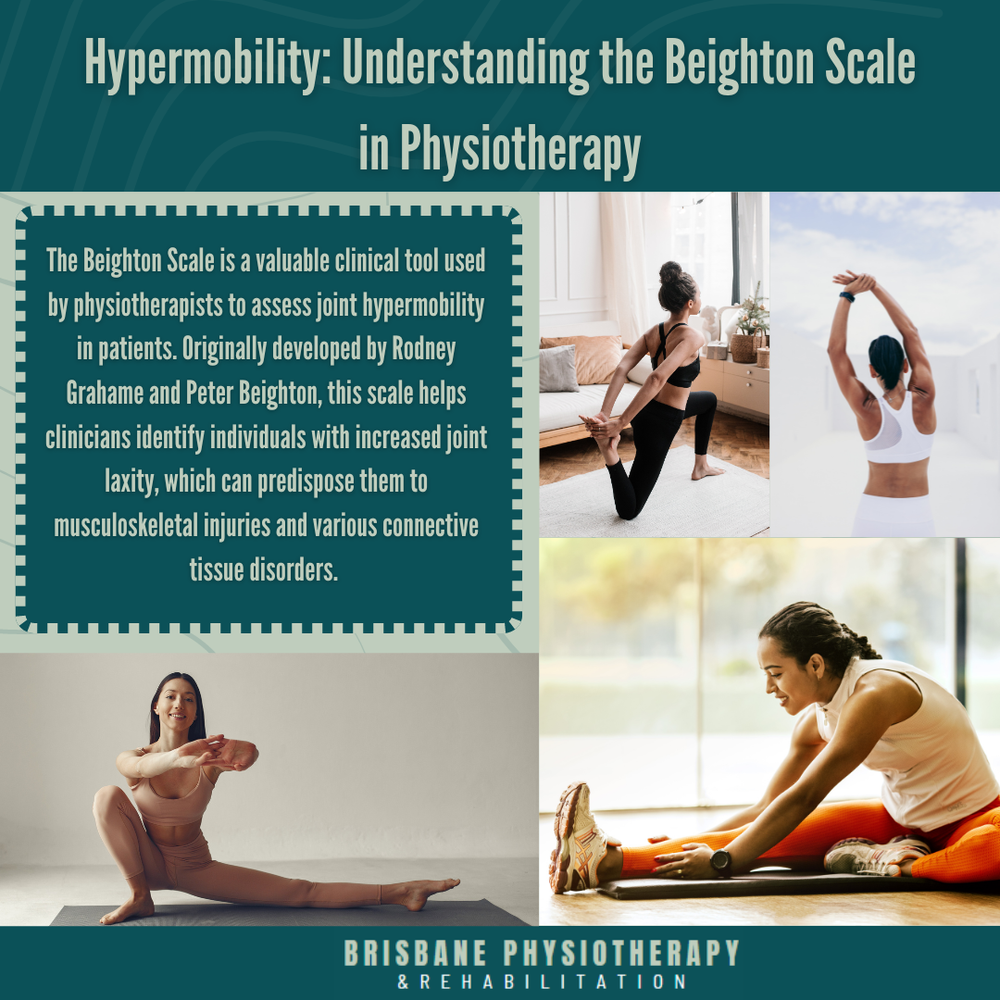 Hypermobility Syndrome: HSD, Beighton Score, Diagnosis & Physio ...