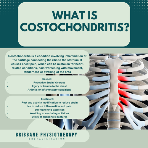 What is Costochondritis? - Brisbane Physiotherapy & Podiatry