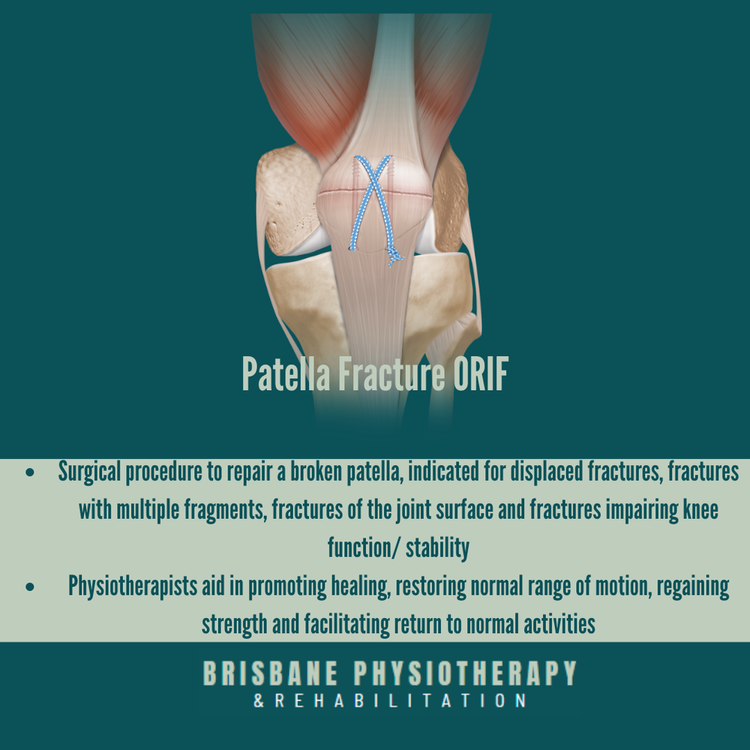 Patella Fracture - What is it? Physio, Rehab, Patella ORIF Knee Surgery ...