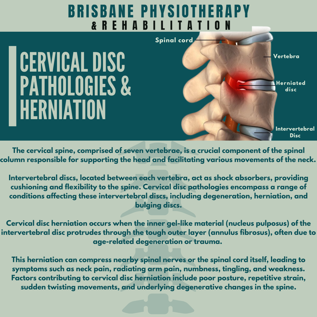Cervical Disc Pathologies and Herniations - Brisbane Physiotherapy ...