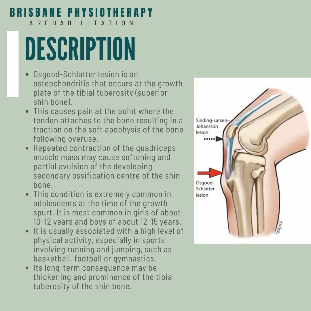 What is a Osgood-Schlatter Lesion? - Brisbane Physiotherapy