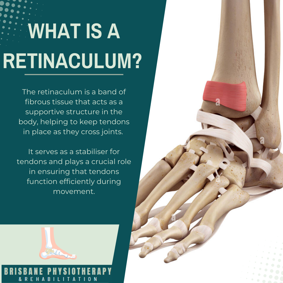 What is a Retinaculum: An Overview - Brisbane Physiotherapy & Podiatry