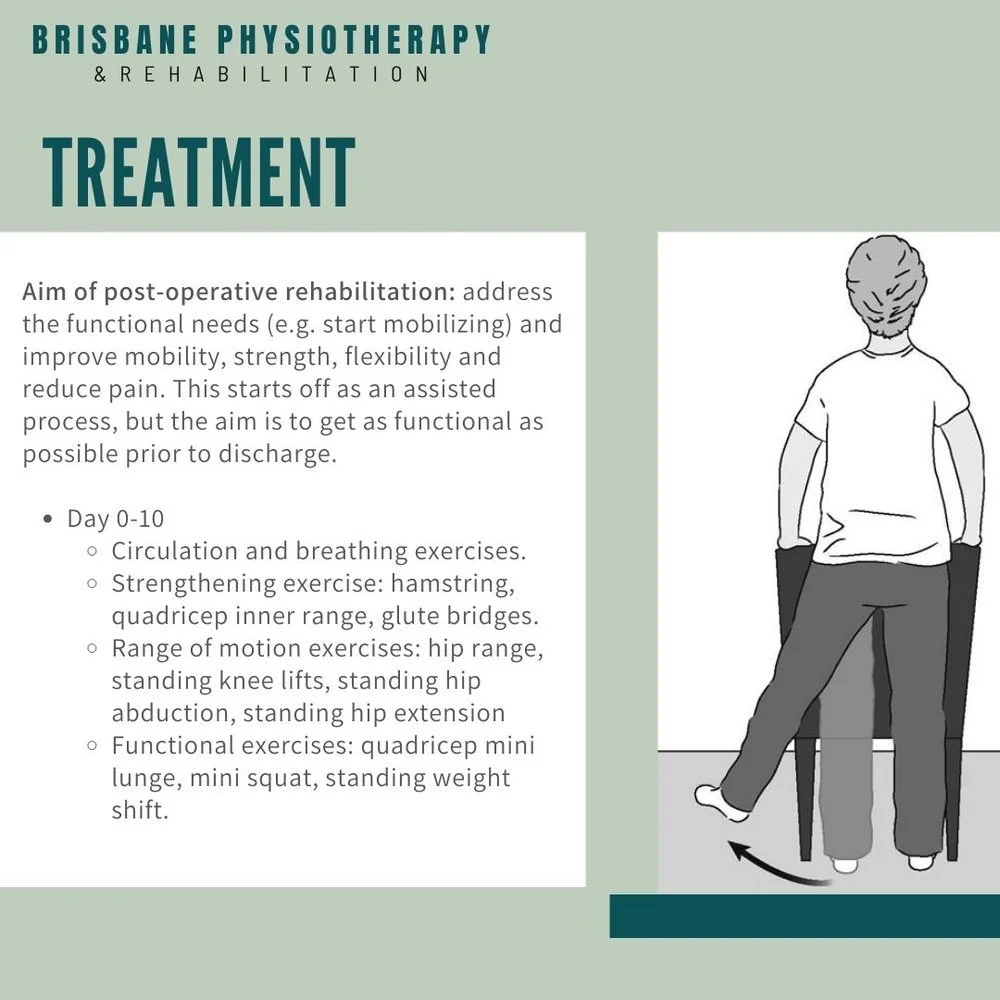 Total Hip Replacement - What is it? Treatment & Physio Rehabilitation ...