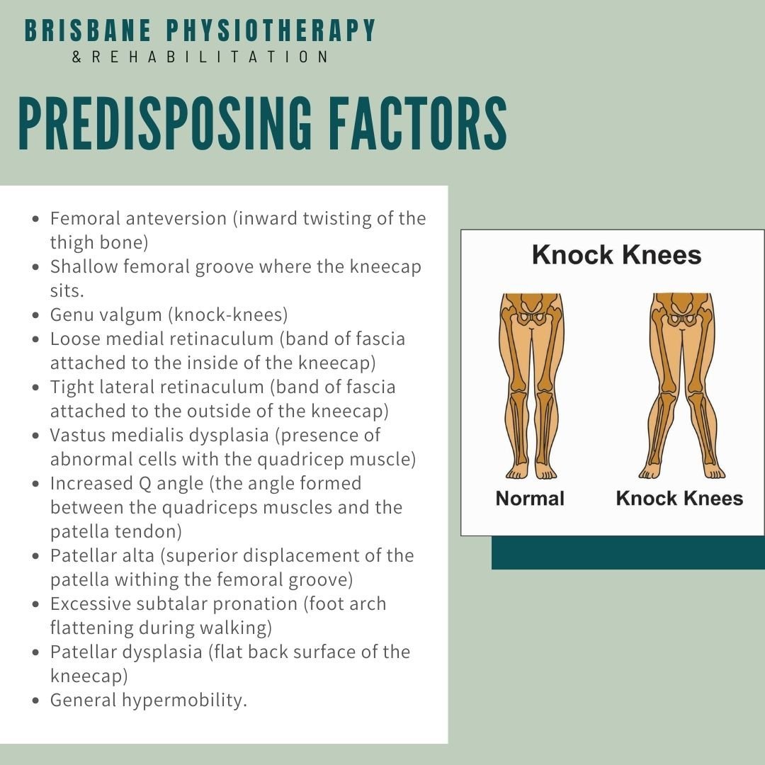 Patella Dislocation Treatment Symptoms Diagnosis Brisbane Physiotherapy