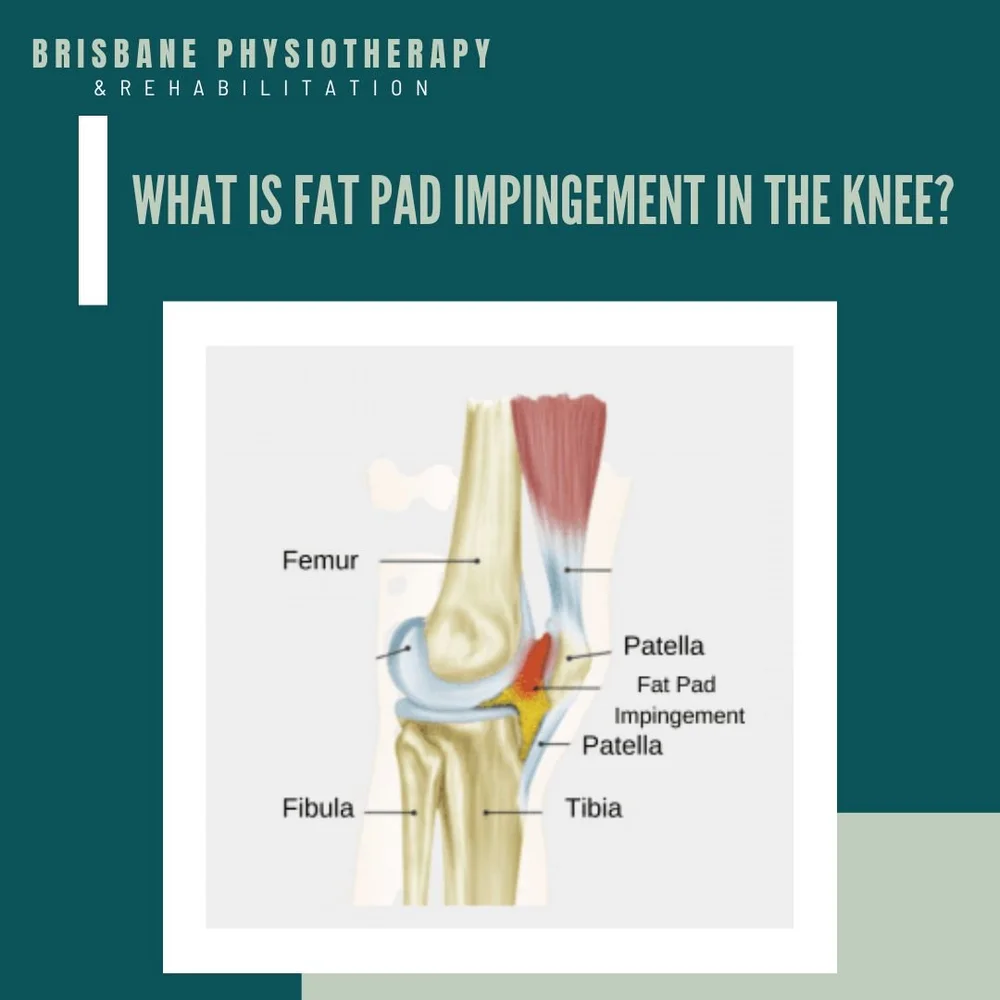 Knee Fat Pad Impingement - Hoffa's Syndrome - Fat Pad Exercises ...