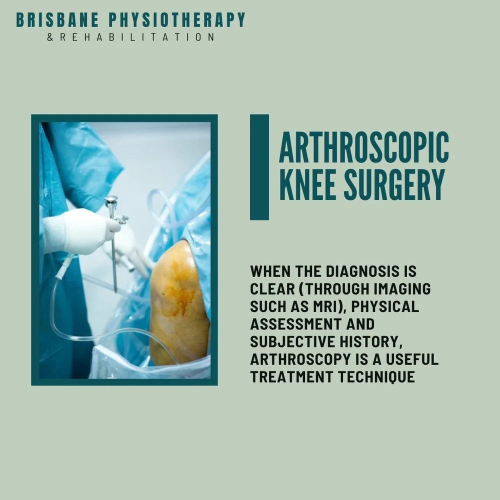 Knee Arthroscopy - Arthroscopic Knee Surgery Recovery & Physio ...