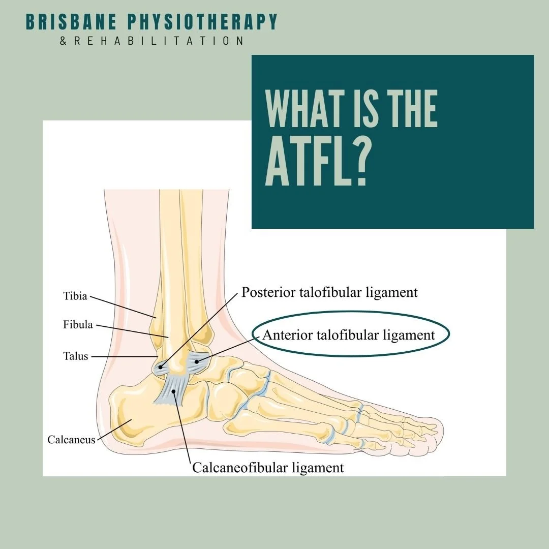 What is the Anterior Talofibular Ligament (ATFL)? - Brisbane ...