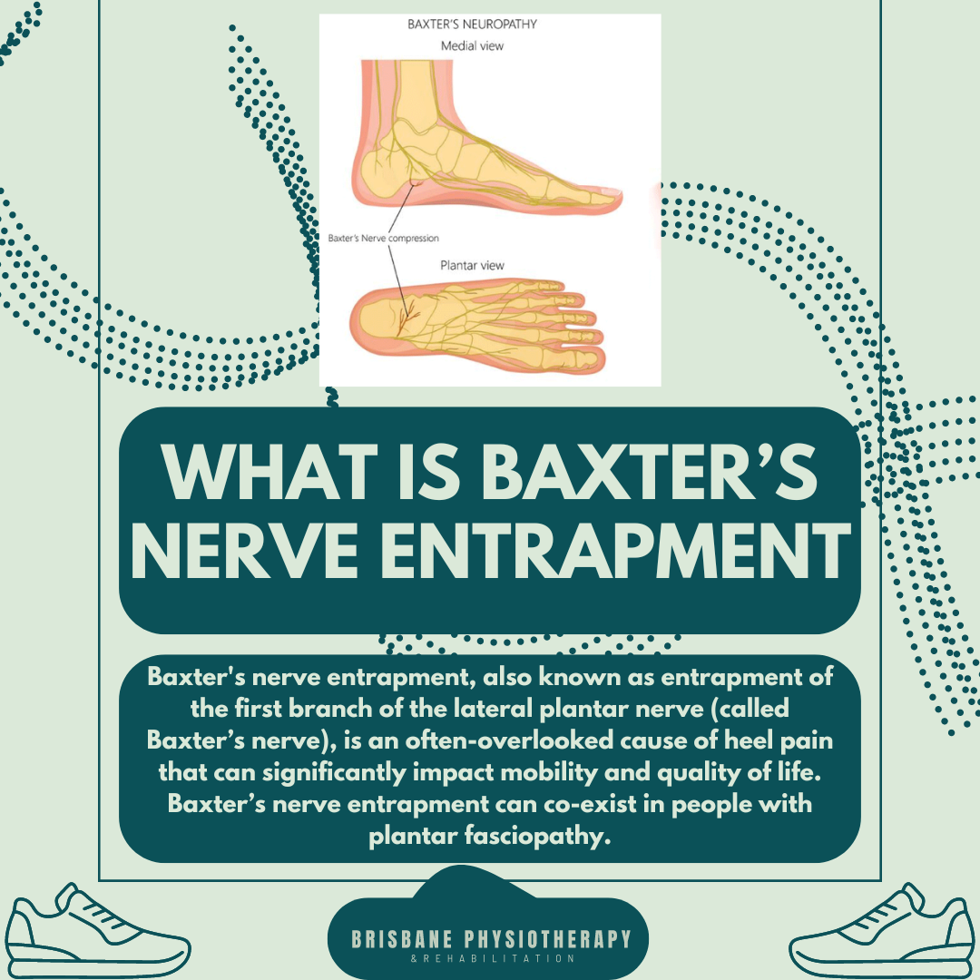 What is Baxter's Nerve Entrapment? - Brisbane Physiotherapy & Podiatry