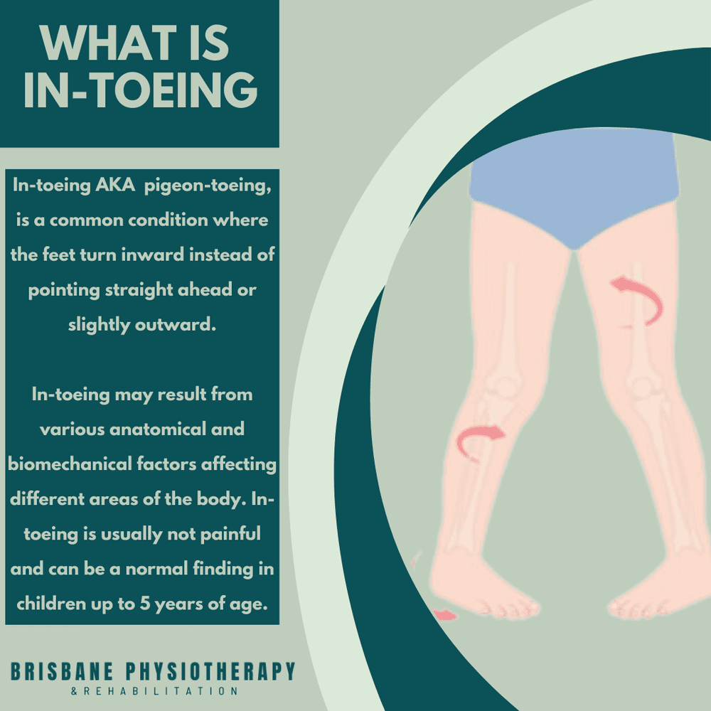 What is In-Toeing? - Brisbane Physiotherapy & Podiatry