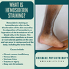 Hemosiderin Staining - Venous Staining - Hemosiderosis Pigmentation ...