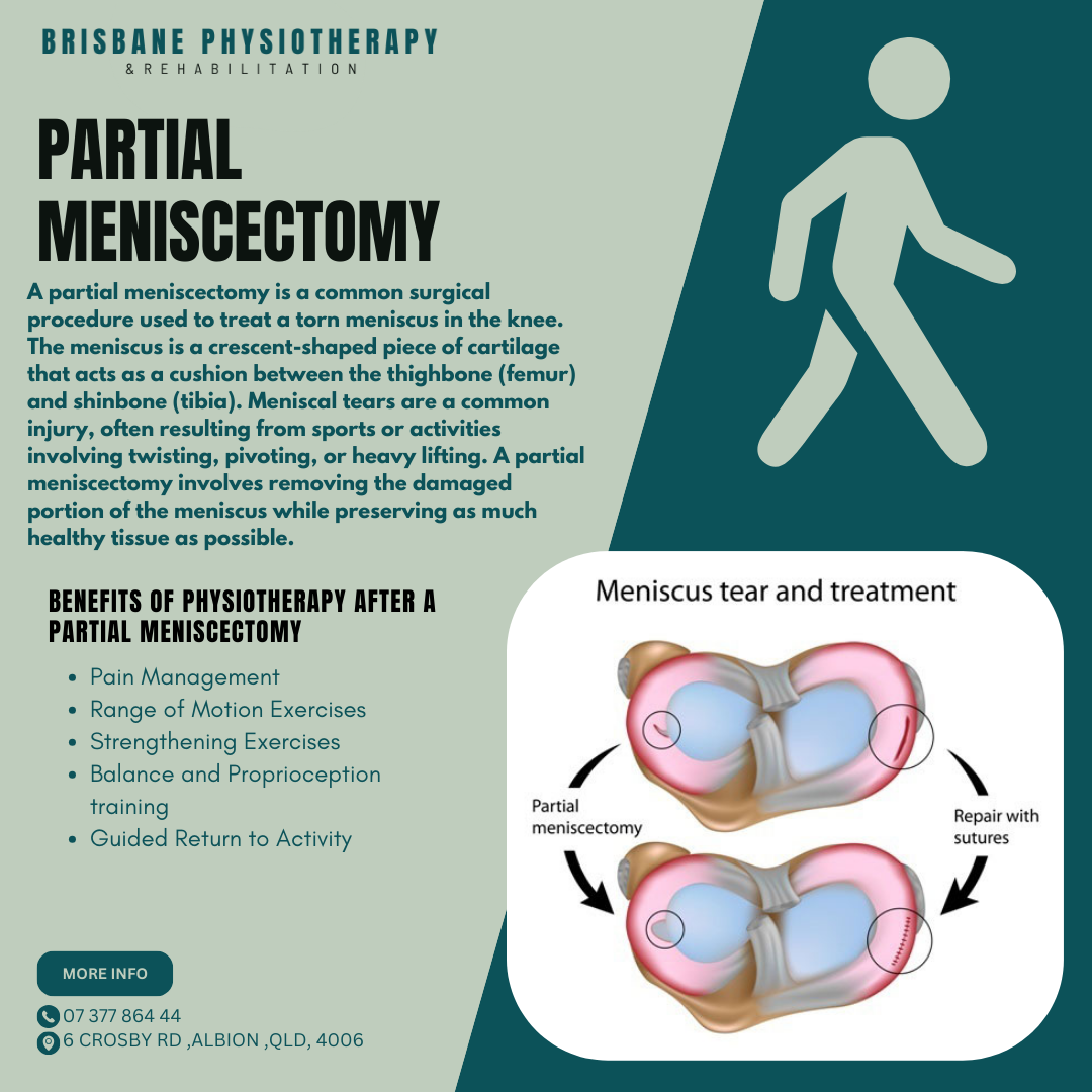 Partial Meniscectomy Brisbane Physiotherapy Podiatry Partial Meniscectomy Brisbane Physiotherapy Podiatry