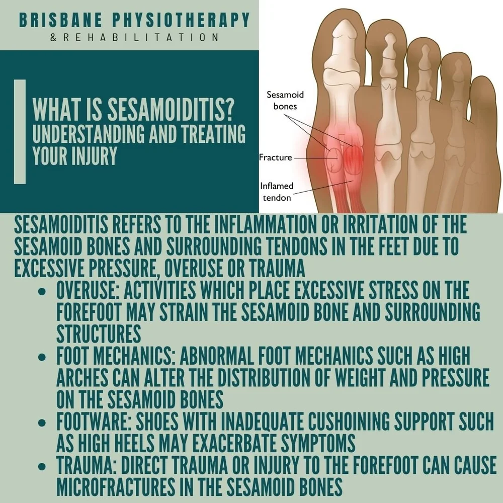 What is Sesamoiditis? - Brisbane Physiotherapy & Podiatry